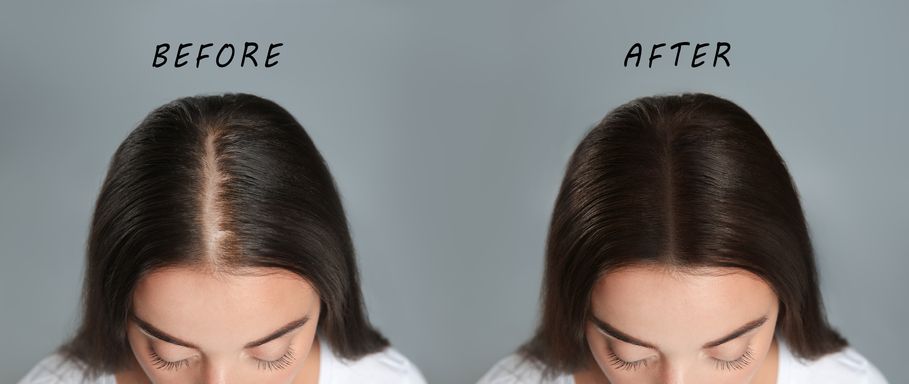 Know How Much Hair Loss Is Normal And How You Can Reduce Hair Shedding